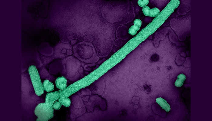Частицы вируса гриппа А приобретают нитевидную форму в неблагоприятных условиях — PCR News