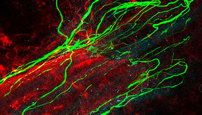Клетки волосяных фолликулов чувствительны к прикосновениям — PCR News