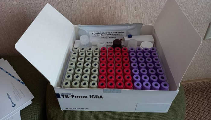Интерфероновый тест на туберкулез TB-Feron работает точнее остальных за ...